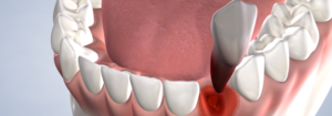 Arizona Oral & Maxillofacial Surgeons